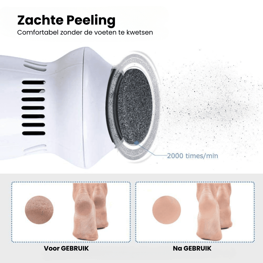 PediMax – Elektrische Eeltverwijderaar met Vacuüm en Oplaadbare ...